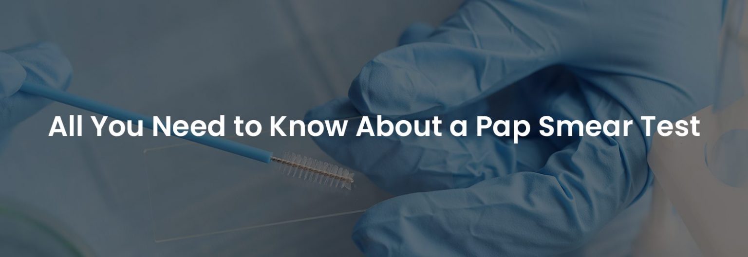All You Need to Know About a Pap Smear Test | EliteCare HC